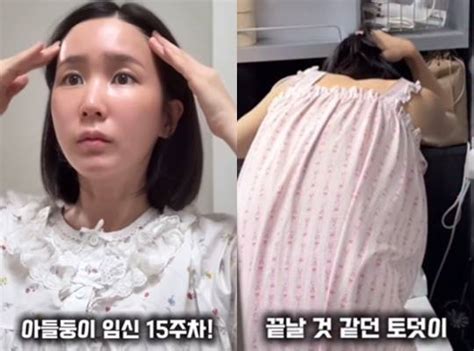 초아 쌍둥이 임신 15주 실핏줄 다 터졌다자궁경부암 극복 후 출산 앞둔 근황