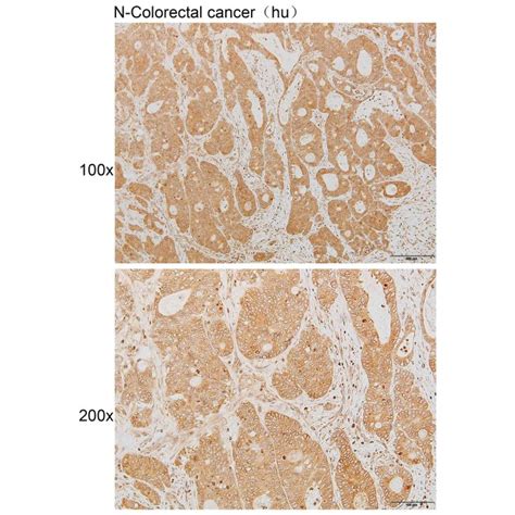 Solarbio K111900p Anti Clic1 Polyclonal Antibody 试剂仪器耗材