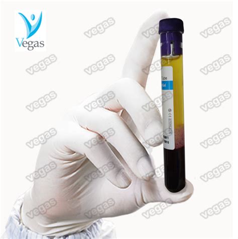 High Concentration Of Platelets 10ml And 15ml Prp Tube And Prp Kit