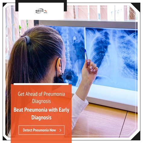 Secomindai On Linkedin Ai Medical Pneumoniadetection Diagnosis