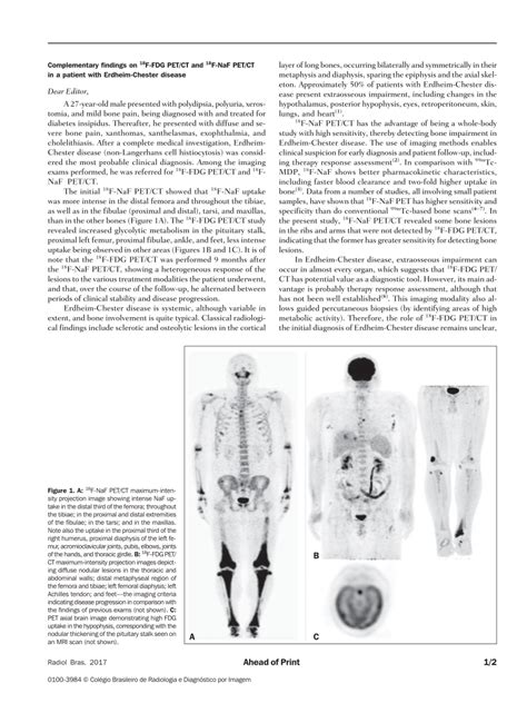 Pdf Complementary Findings On 18f Fdg Petct And 18f Naf Petct In A