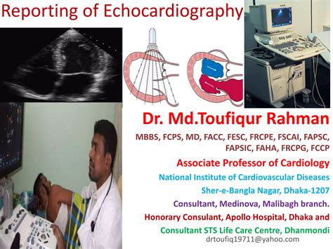 Echo Reporting Basics Ppsx