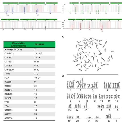 Analysis Of Unique Str Genotype Profile And Karyotype Of Zx2021h Cells