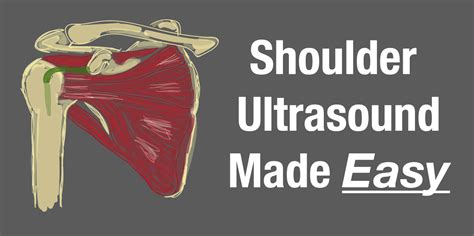 Musculoskeletal Pocus 101