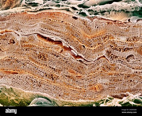 Cardiac Muscle Coloured Scanning Electron Micrograph Sem Of A Bundle