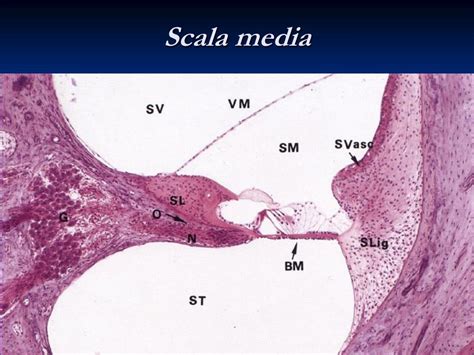 Ppt Auditory And Vestibular System Powerpoint Presentation Free
