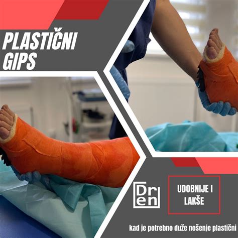Nekad Je Gips Neophodan A Plastični Dr Dren Ortopedija Facebook