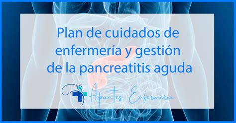 Plan de cuidados y gestión de enfermería pancreatitis aguda