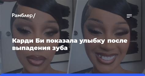 Рэперша Карди Би опубликовала фото с выпавшим зубом Рамблер новости