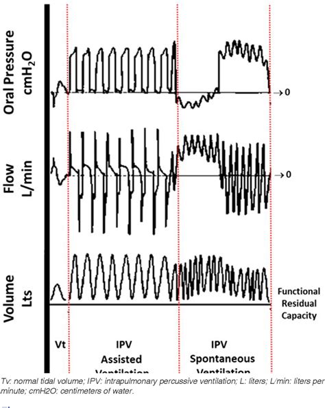 Figure 1 From Use Of Intrapulmonary Percussive Ventilation As