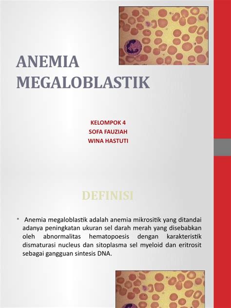 Anemia Megaloblastik Pdf