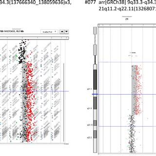 ArrayCGH Analysis Of DNA From Patient MP03 Profile Of Chromosome 21 Download Scientific