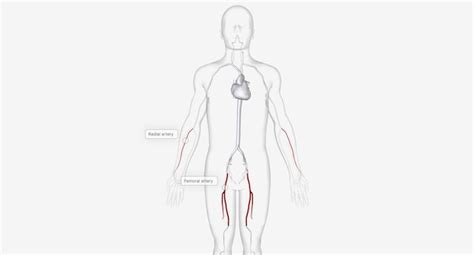 Premium Photo The Arteries For Catheter Insertion