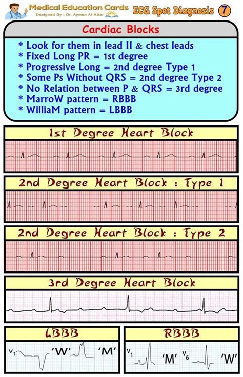 Cardiac More Nursing School Studying Nursing School Notes Nursing