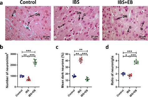 The Estimation Of The Number Of Cortical Neurons A Photomicrograph Of