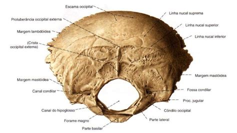 Neurocrânio Frontal Parietal Occipital Temporal Esfenoide E