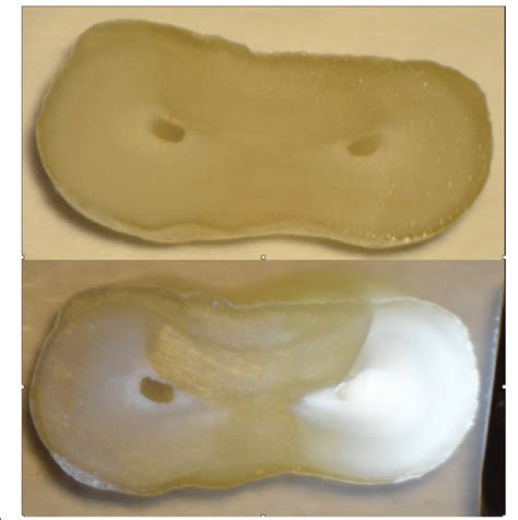 Image Showing A Full Thickness Dentinal Defect Revealed Through Led Download Scientific Diagram