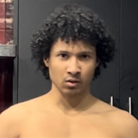 Is My Midface Long Does My Midface Length Reduce The Harmony Of My