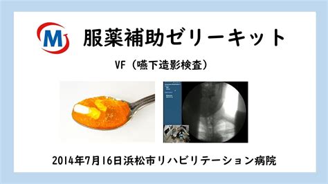 VF嚥下造影検査2014年7月16日浜松市リハビリテーション病院 YouTube
