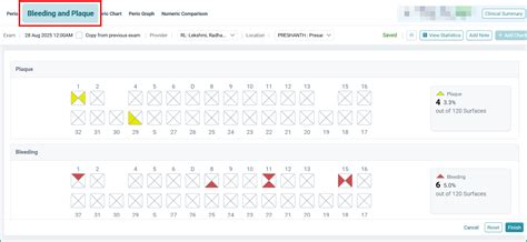 Explore Perio Charting Carestack User Resource Center