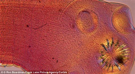 Chinese Woman Has Eight Foot Long Tapeworm Removed From Her Intestines