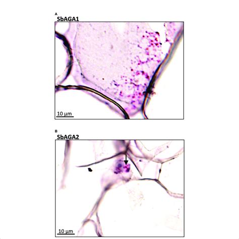 Rnascope Data Showing The Localization Of Expression Of Sbaga1 And Download Scientific Diagram