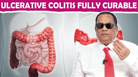 Ulcerative Colitis Fully Curable Drcknandagopalan Youtube