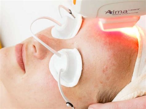 1 Skin Treatment Near Infrared NIR Skin Tightening