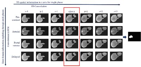 4d Information In The Proposed Deep Learning Model 3d Spatial Context Download Scientific