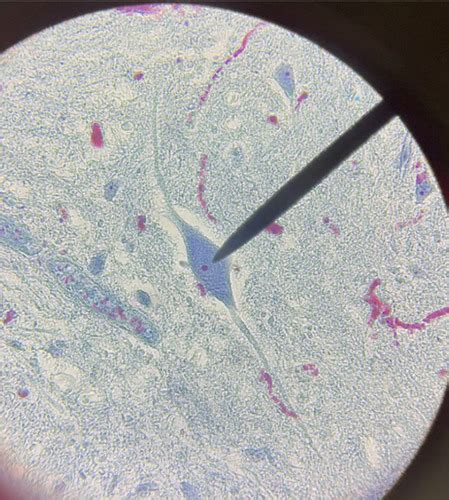 HISTO FINAL PRACTICALS FROM 1ST TO RESPI Flashcards Quizlet