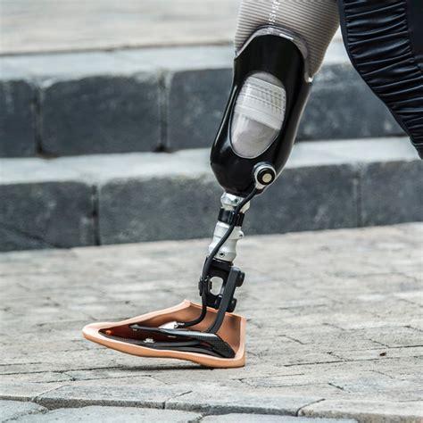 Prosthetic Sockets And Suspension Leimkuehler Oandp Center Prosthetic Sockets And Suspension Leimkuehler Oandp Center