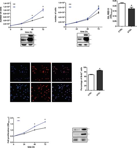 Atgl Over Expression Is Associated With Increased Proliferation Rate In