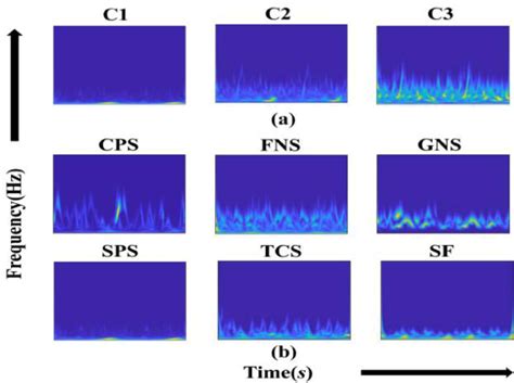 Figure 7 From Seizure Types Classification By Generating Input Images