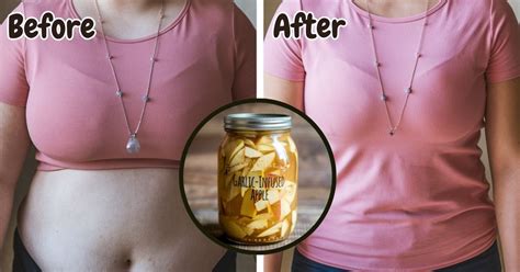 Garlic Infused Apple The Surprising Weight Loss Combo You Need To Try