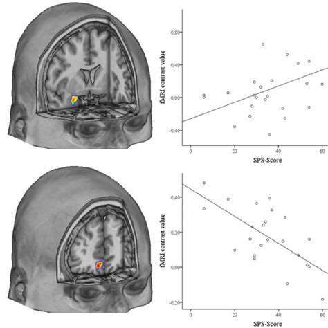 Region Of Interest Analysis Of The Amygdala Left Bar Graphs Depicting