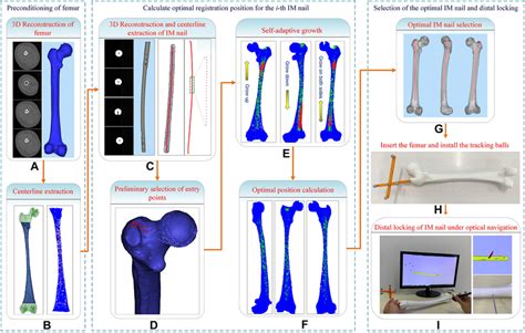 System Flow Chart Of The Computer Assisted Preoperative Selection