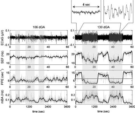 Time Course Of The Original Recorded Ecog And The Estimated Sef Download Scientific Diagram