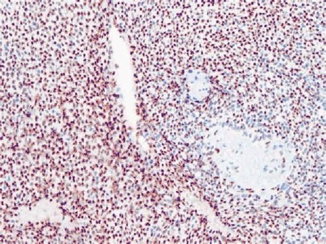 Tle1 Epr93862 Biocare Medical