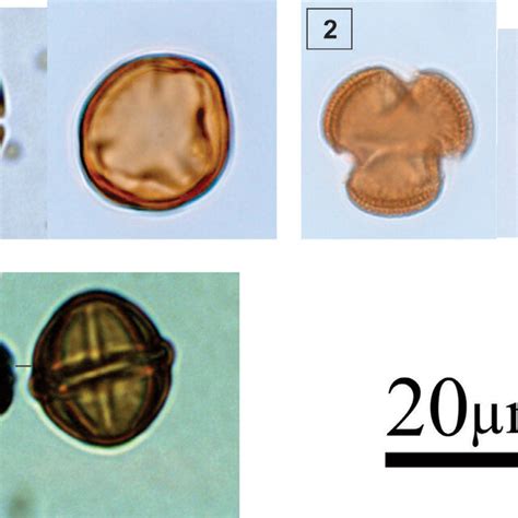 Light Micrographs Of Mangrove Taxa Including 1 Laguncularia Racemosa