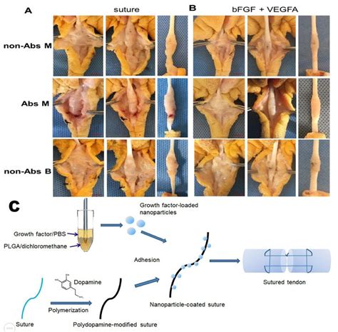 A Effect Of Ordinary Suture On Repairing Tendon Adhesion B Effect Download Scientific