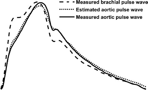 Comparison Among The Measured Brachial Pulse Waveform Bold Dotted Download Scientific Diagram