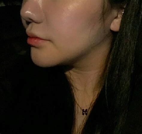 파워v얼굴지방흡입 이중턱근육묶기 보톡스 후기 닥터정 리반의원