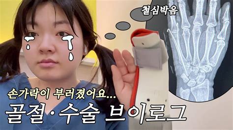 🤙🏻손가락이 부러졌어요😫 수술하고 재활하는 손가락 골절 브이로그🦾 • 은구슬 Youtube