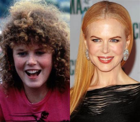 25 Imagens Chocantes De Celebridades Antes E Depois Da Fama Minilua
