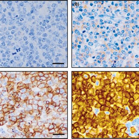 Correlations Of Cd28 Messenger Rna Mrna Levels Cd28 Protein