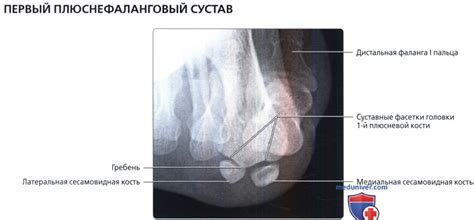 Плюснефаланговый сустав стопы где находится фото