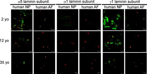 Immunostaining for laminin α left α middle and γ subunit Download Scientific Diagram