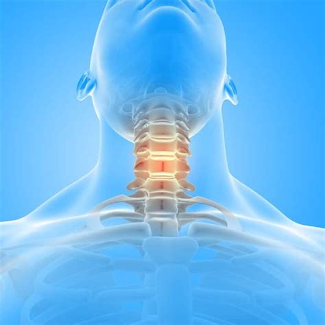 Heres Everything To Know About Cervical Ribs Or Extra Ribs