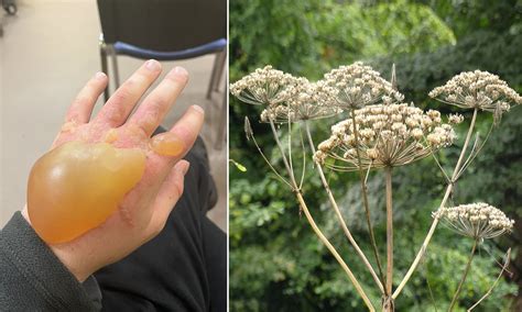 Hogweed Plant Hogweed Naturespot