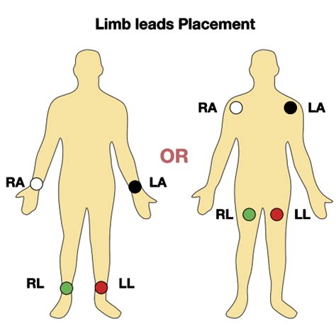 Ecg Basics Visualmed Clinical Trials